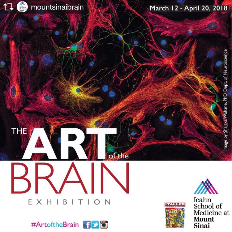 “Art of the Brain” Exhibition – SciArt that’ll make you feel Smart